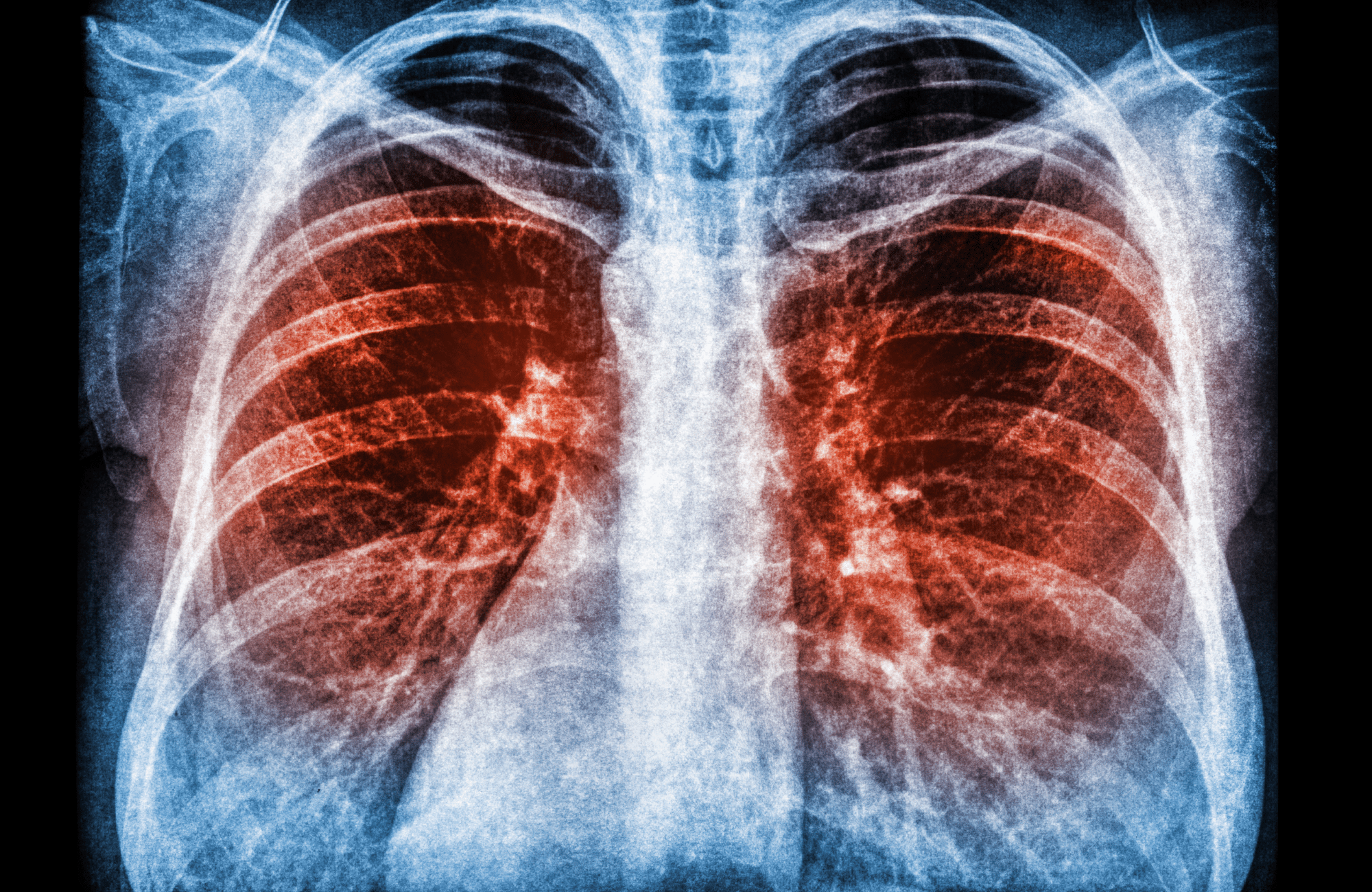 Lung functional imaging - ERS - European Respiratory Society
