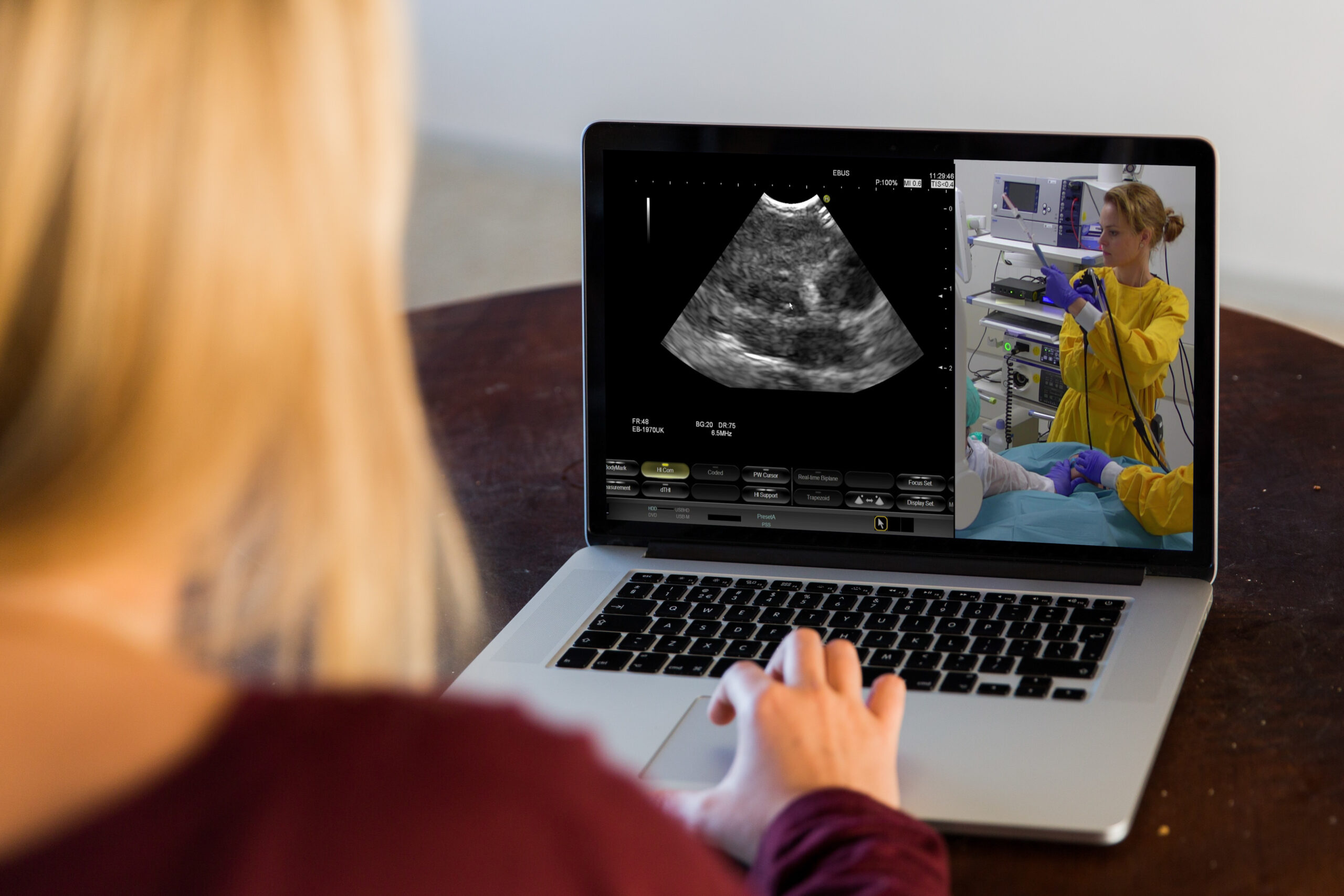 EBUS training programme – part 3 - ERS - European Respiratory Society